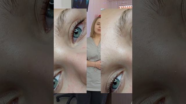 Ламинирование ресниц 💣