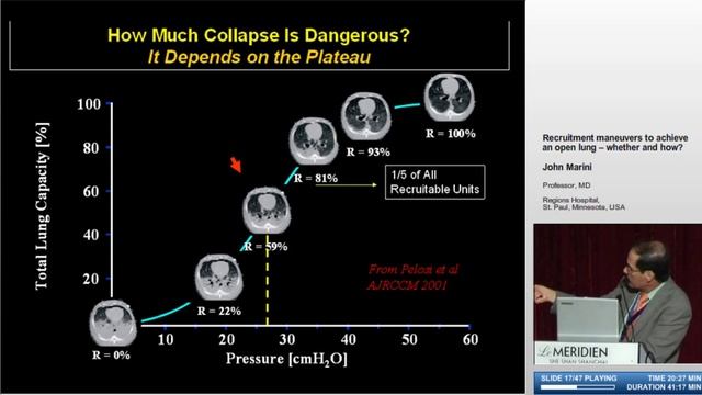 Recruitment Maneuvers to open lung J.J.Marini-2 (2006 Shanghai)