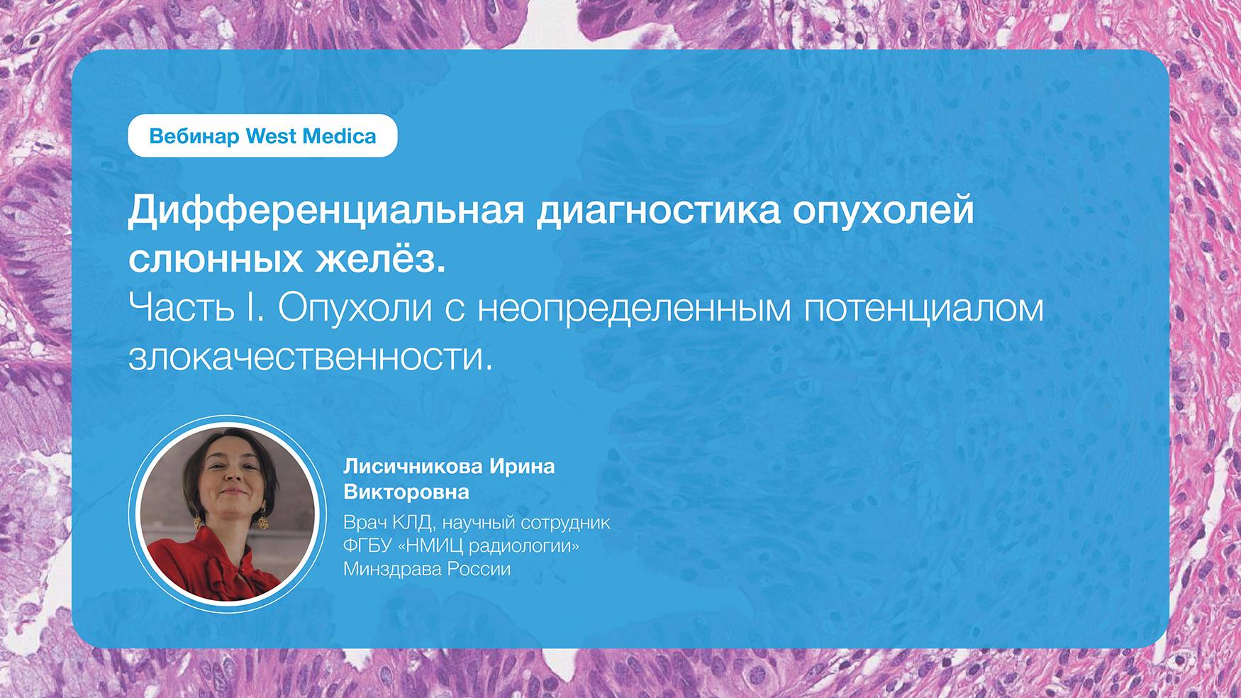 Дифференциальная диагностика опухолей слюнных желёз. Часть 1 | Вебинар West Medica