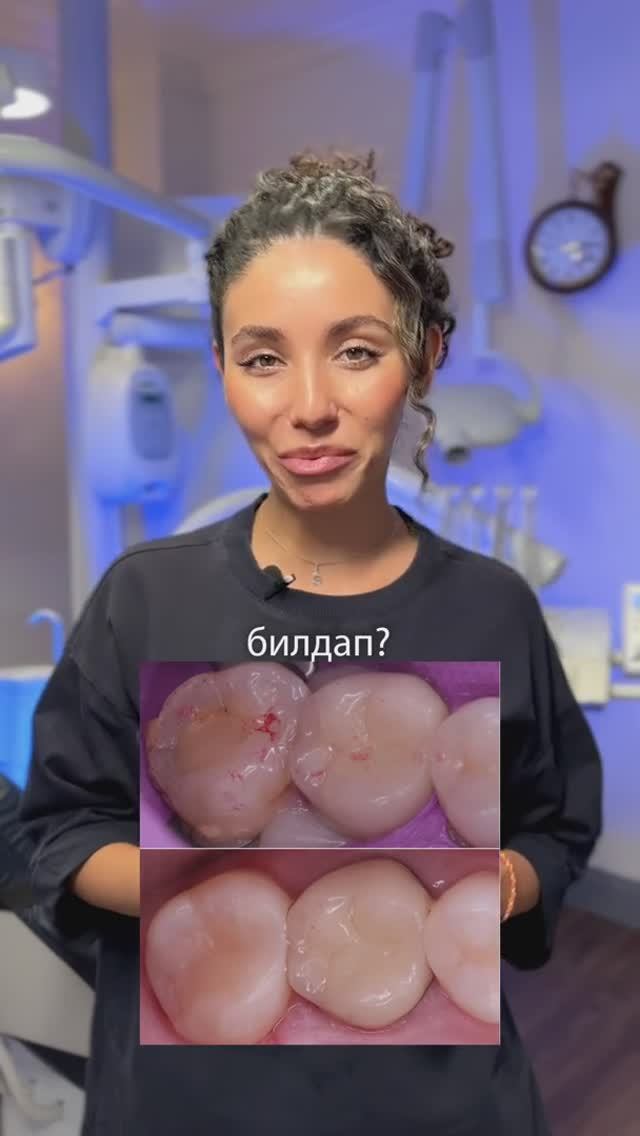 Что такое Билдап (BuildUp)?