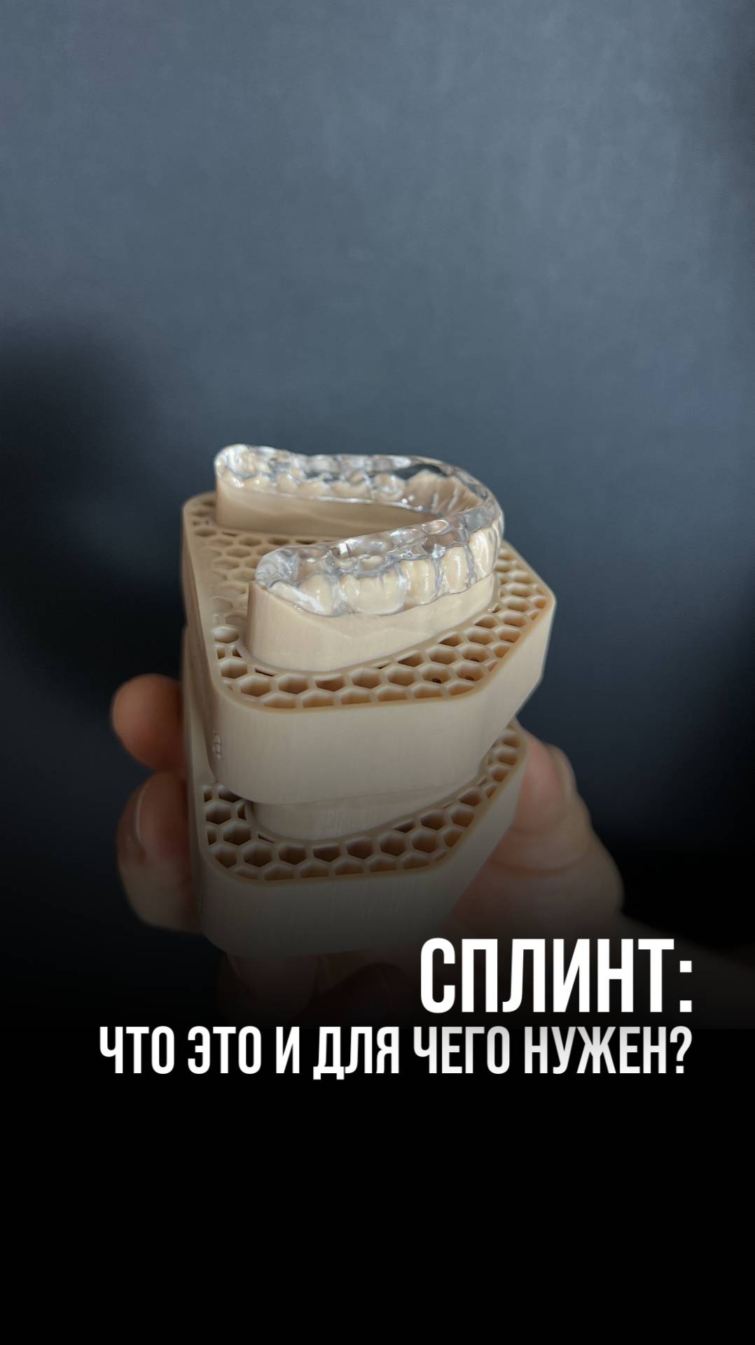 Сплинт: что это и для чего он нужен?