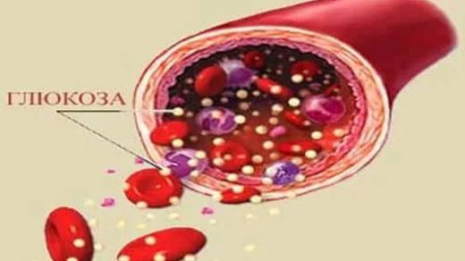 ПОЧЕМУ НА КЕТО ДИЕТЕ САХАР ПОВЫШАЕТСЯ А ВЕС НЕ СНИЖАЕТСЯ