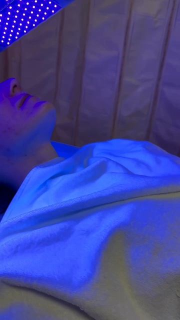 Фотодинамическая терапия