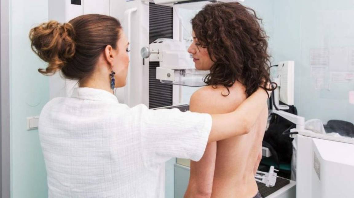 ПАМЯТКА РЕНТГЕНЛАБОРАНТУ. МАММОГРАФИЯ. ПРОЕКЦИИ КУРС МАММОЛОГИИ МУСТАФИН ЧИНГИС +7 985 9 245245