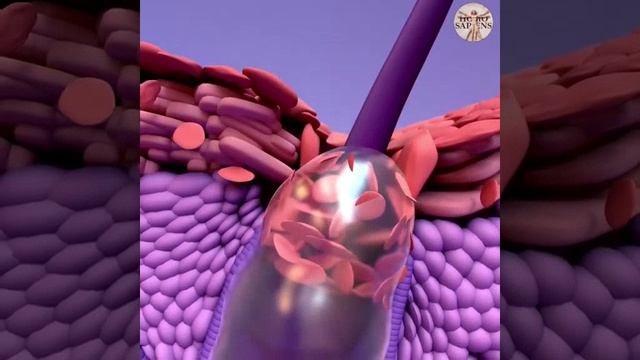 🚑Как избавиться от прыщей всего за 1 ночь?🚑👉В ОПИСАНИЕ👈