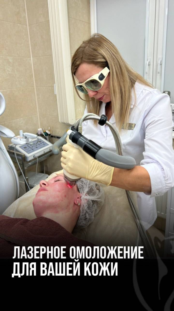 Лазер для молодости вашей кожи