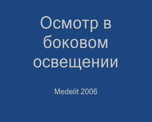 Осмотр глаз в боковом освещении