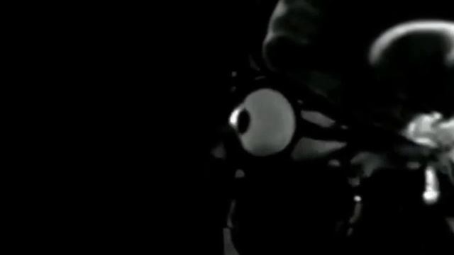 Вот так выглядит трение глаз на МРТ