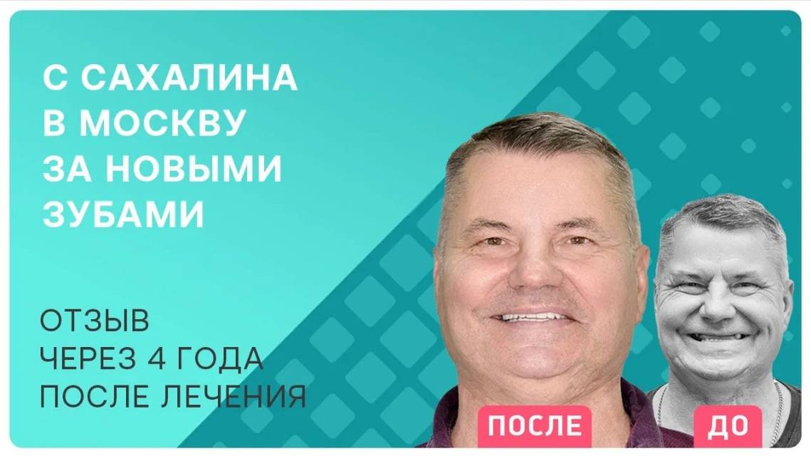 Почему я не стал делать имплантацию зубов на Сахалине, а отправился в Москву? Делюсь своим опытом!