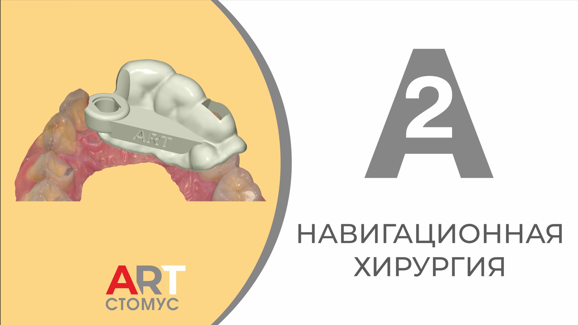 НАВИГАЦИОННАЯ ХИРУРГИЯ А2