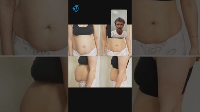 Как поднять внутренние органы/ Как убрать живот/ Как худеть правильно - Ответы на вопросы в ПЭ