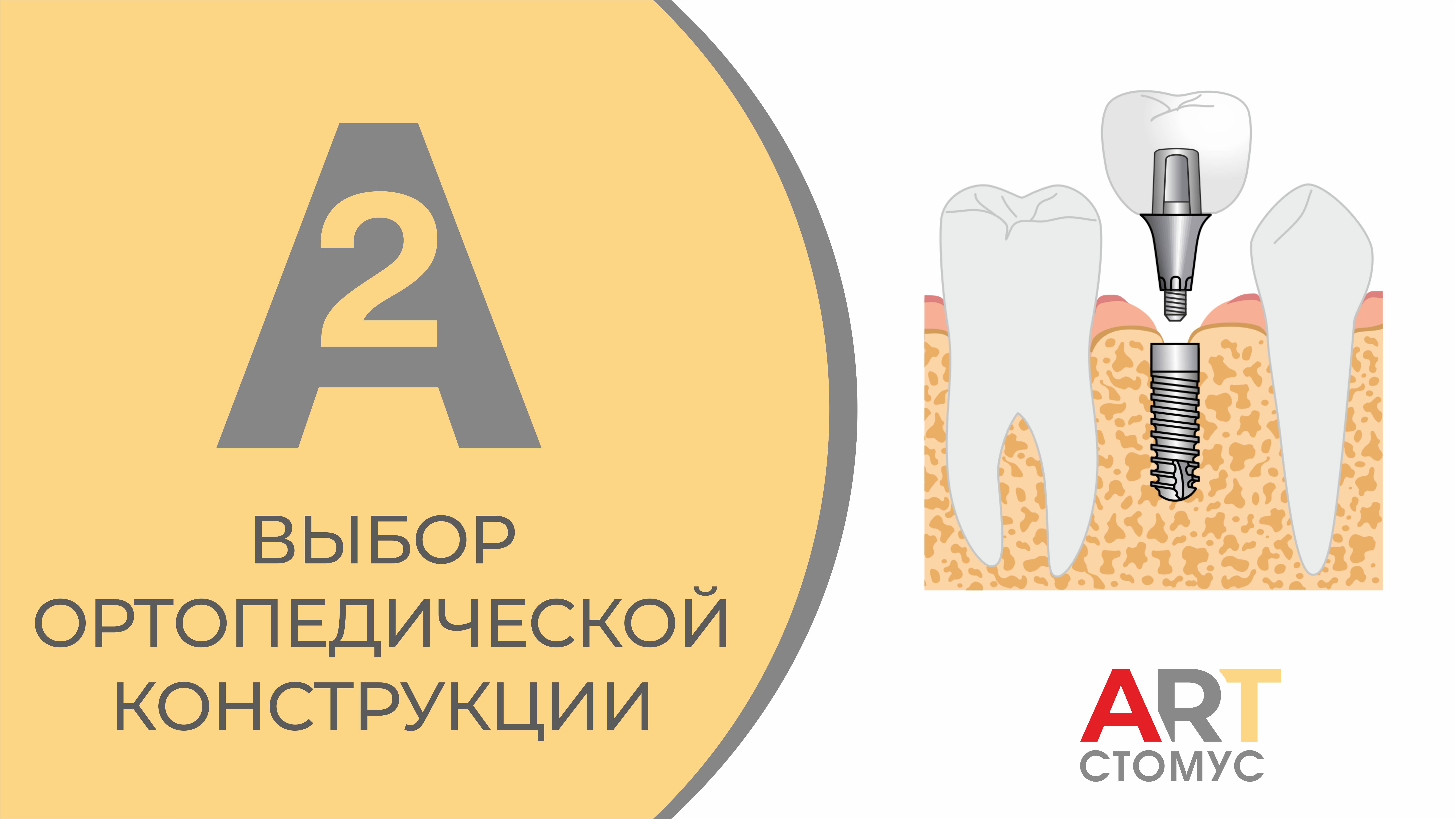 ВЫБОР ОРТОПЕДИЧЕСКОЙ КОНСТРУКЦИИ НА А2