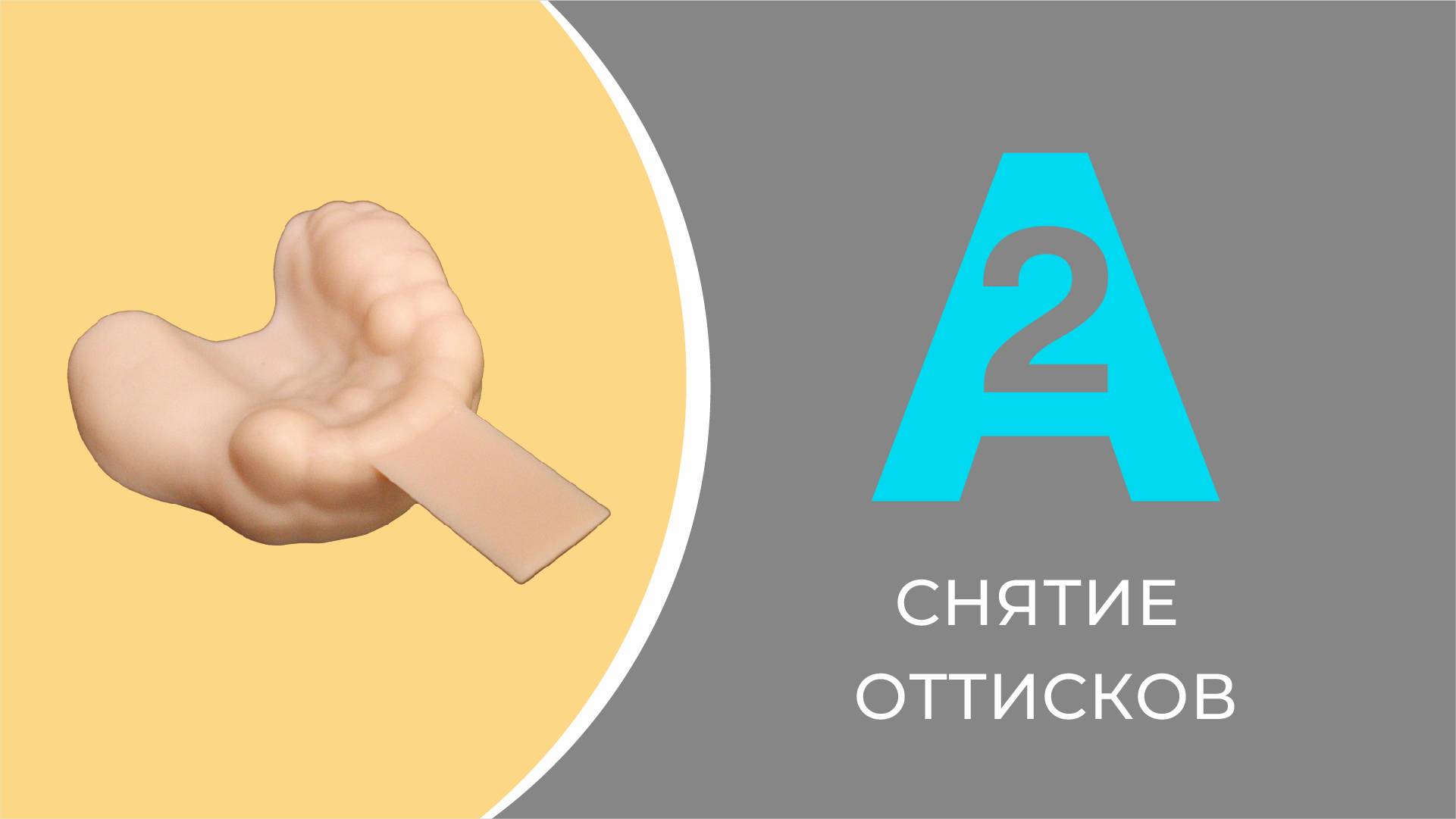 ПЕРЕНОС ИНФОРМАЦИИ О ПОЛОЖЕНИИ ИМПЛАНТАТА  А 2 В ЛАБОРАТОРИЮ