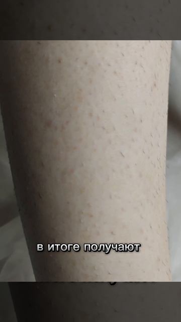 Вросшие волосы на ногах
Депиляция  шугаринг воск