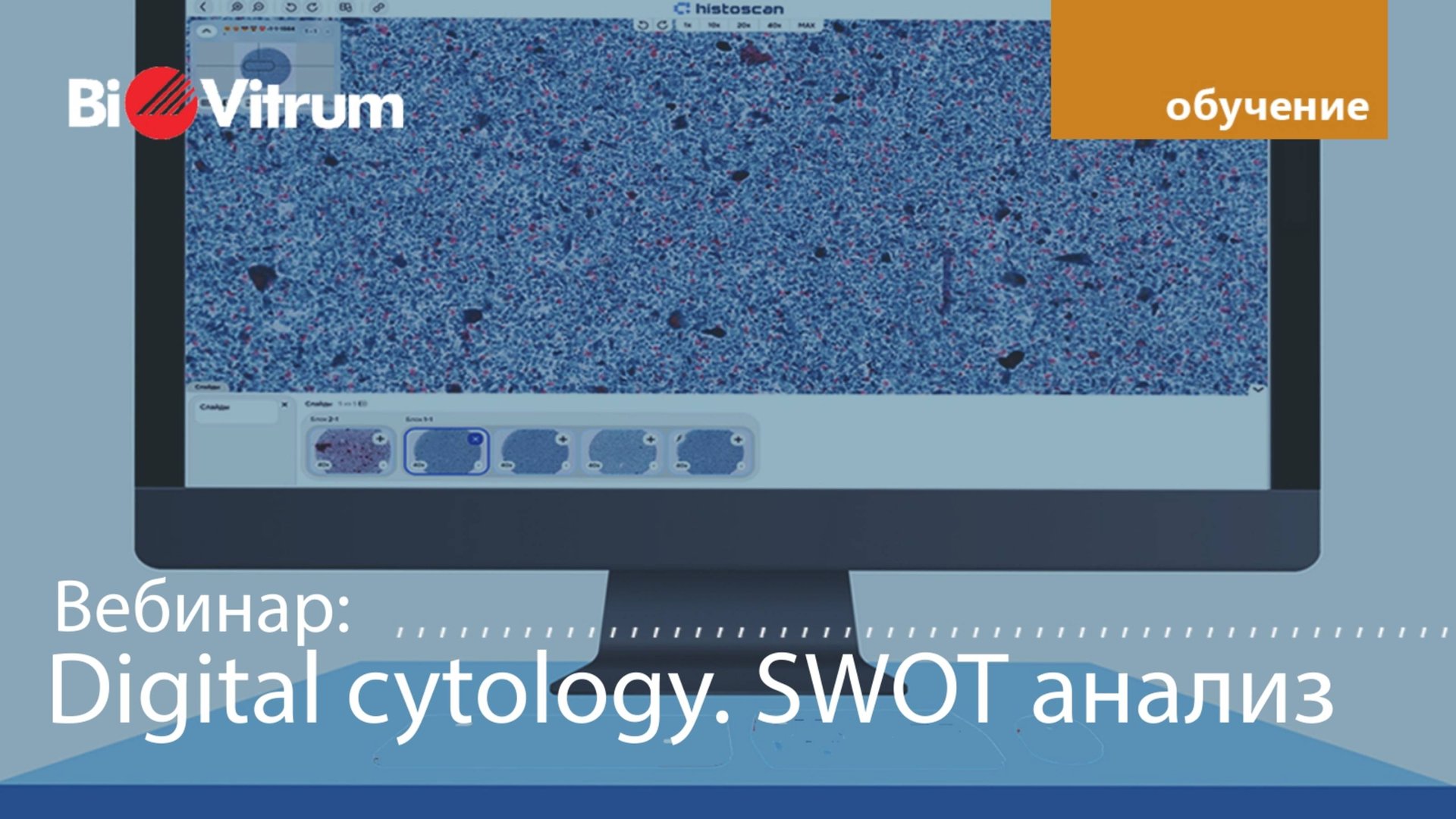 Digital cytology. SWOT анализ