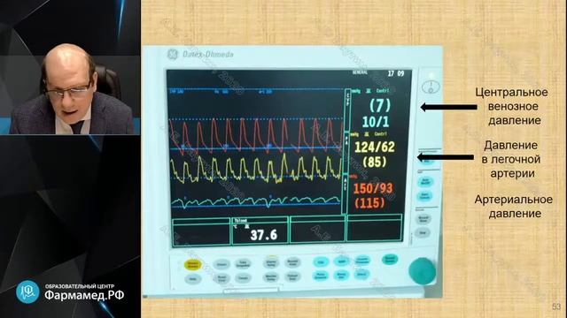 ОПЖСН и легочная гипертензия в МКС  Баутин А.Е.