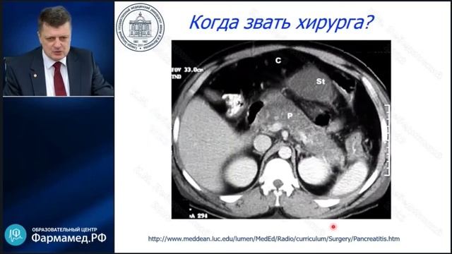 Интенсивная терапия острого панкреатита Лебединский К.М.