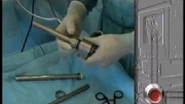 Работа морцеллятора