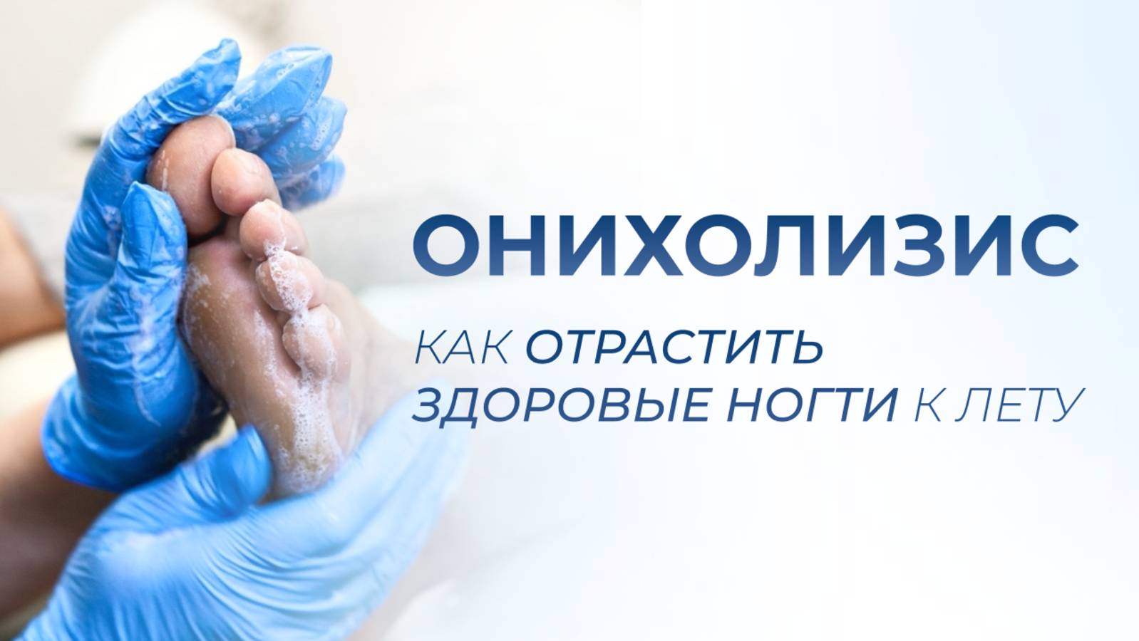 Онихолизис. Как отрастить здоровые ногти к лету?