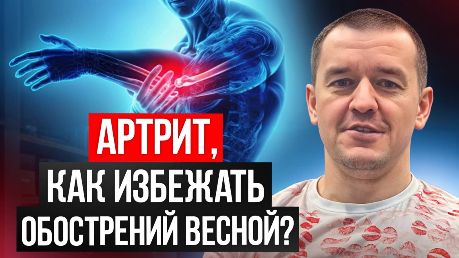 Артрит. Как избежать обострений весной