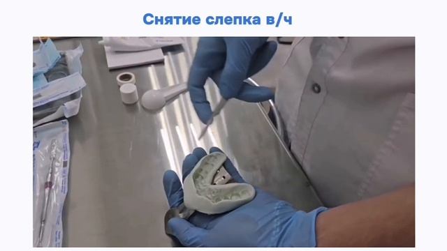 С-силикон (двойной оттиск в/ч и н/ч)