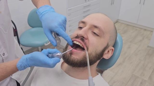 Слепок с пленкой