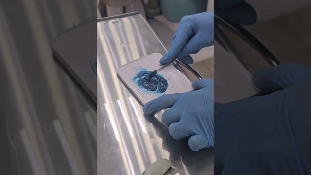 Одноэтапный слепок С-силиконом