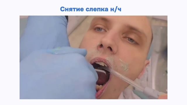 Методика снятия оттиска