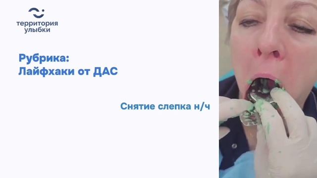 Лайфхаки от ДАС. Снятие слепков