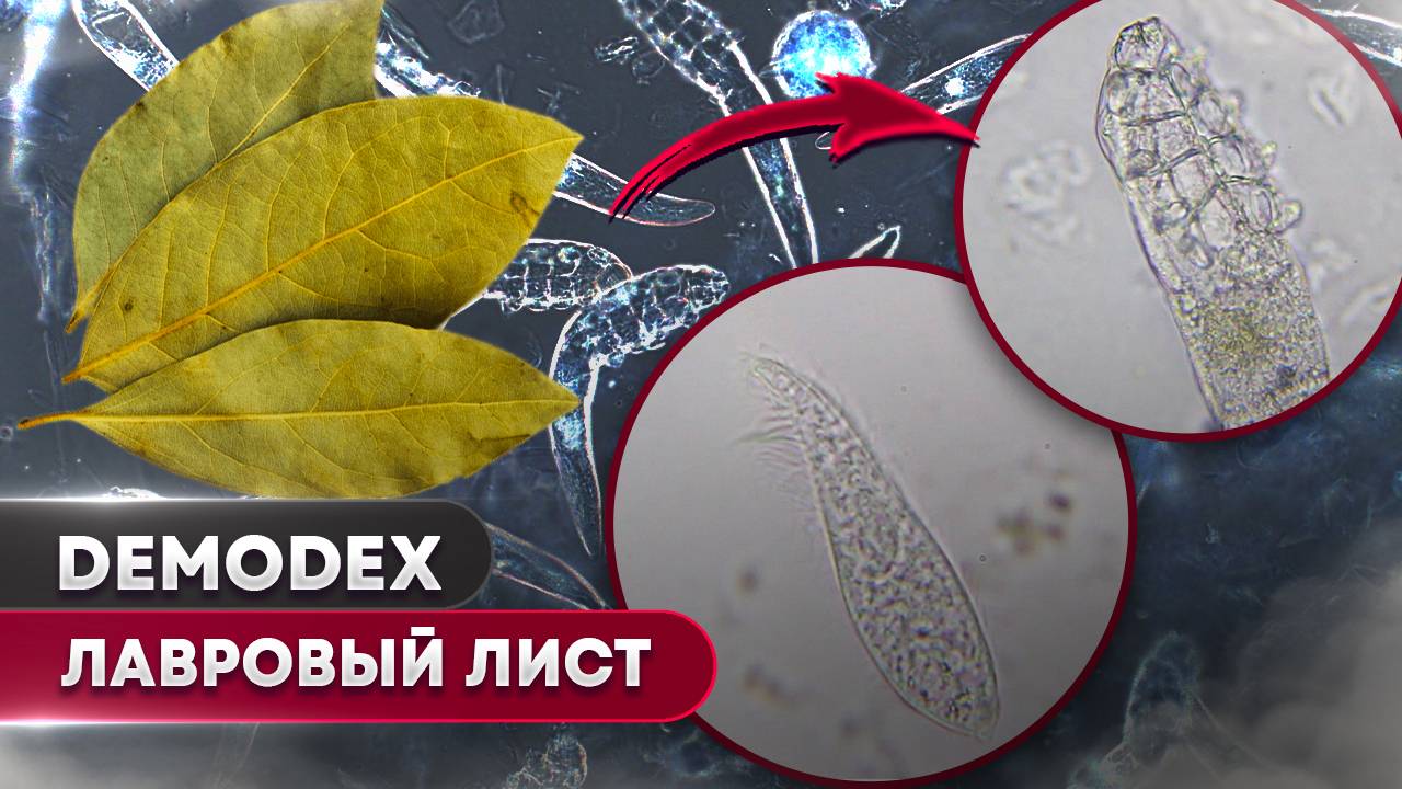 🔬 Лавровый лист против клеща демодекс – правда или миф? | Эксперимент под микроскопом!