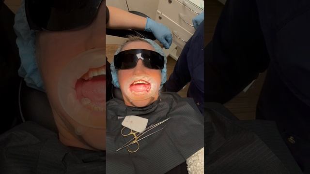 Рана после удаления зуба затянулась на глазах у врачей.