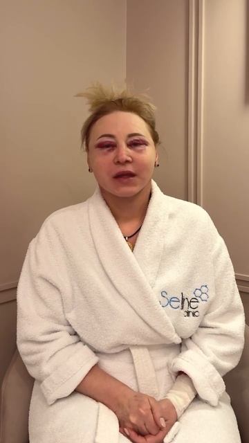 ОТЗЫВ ПОСЛЕ ТОТАЛ ФЭЙС. Доктор Карапетян