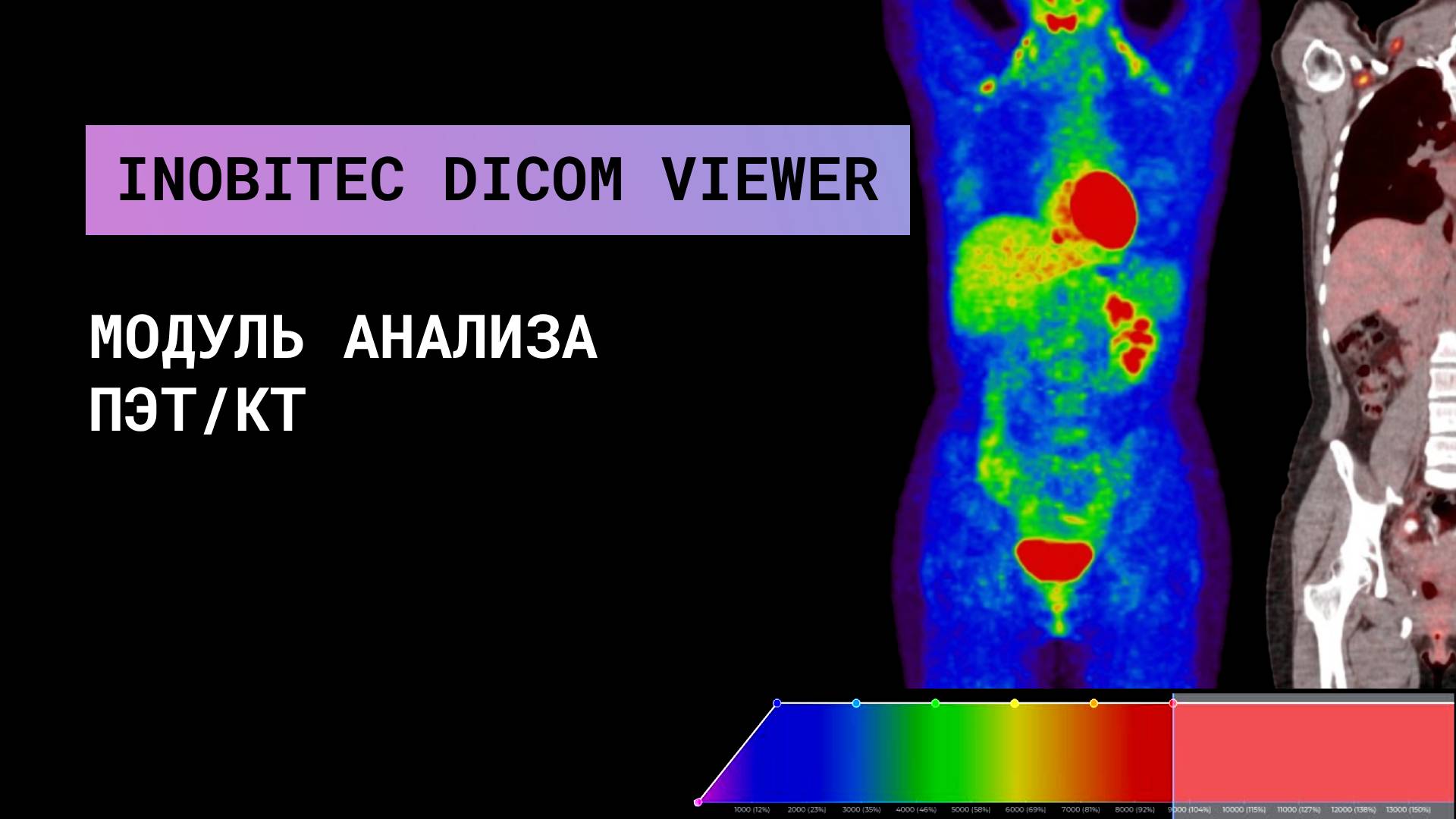 Анализ ПЭТ/КТ в Инобитек DICOM-Просмотрщике, Редакция Pro