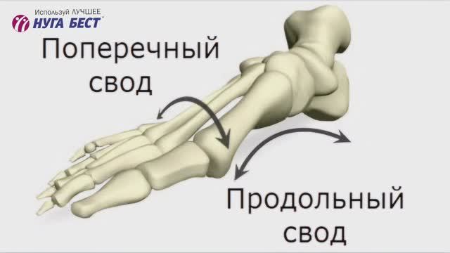 Доктор Карпова Т.В. О плоскостопии и как избавиться