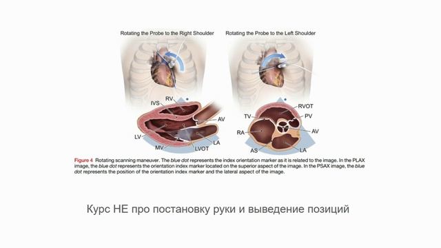 Эхокардиография для специалистов первичного звена