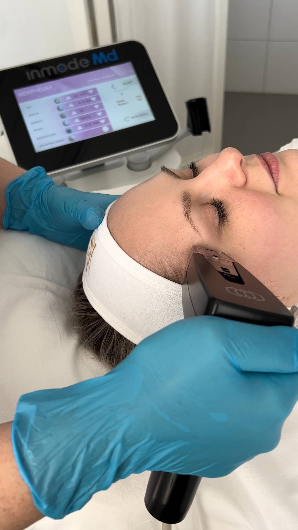 Микроигольчатый RF-лифтинг. Клиника косметологии Челябинск.