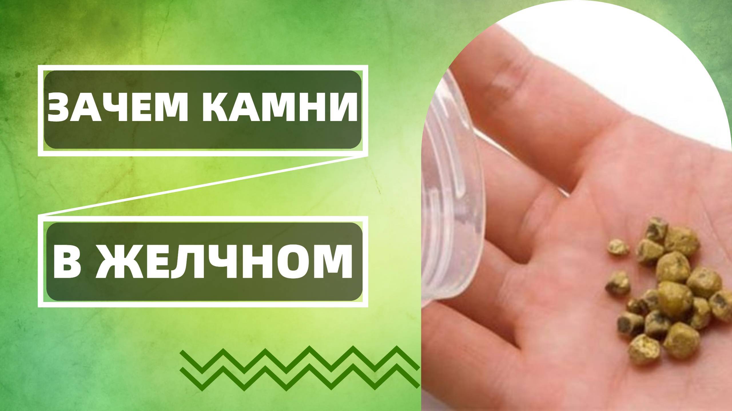 Зачем нам камни в желчном?