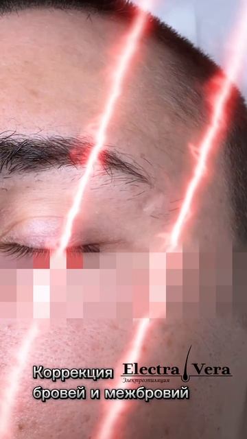 Коррекция мужских бровей и межбровий