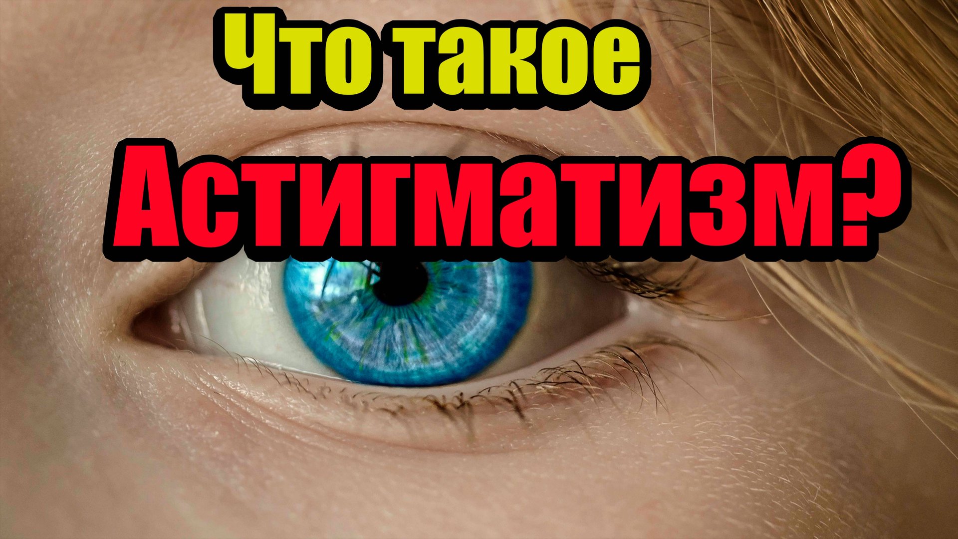 Что такое астигматизм? 👁🗨 Как его лечить?