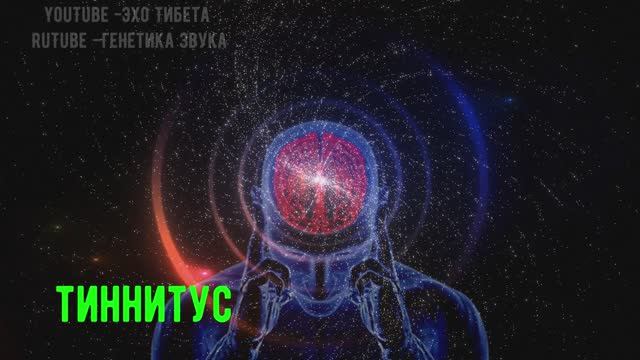 Матрица Гаряева «Устранение шума в ушах» | Тиннитус | Восстановление слуха