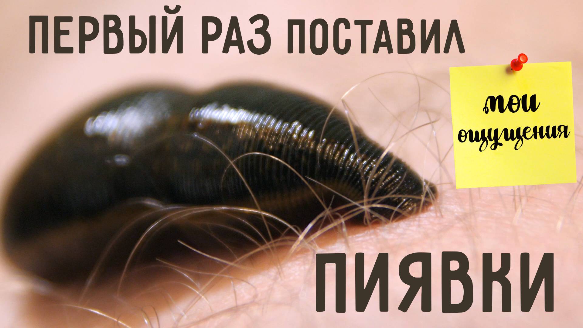 Самостоятельно поставить пиявки. Гирудотерапия в домашних условиях. Впервые ставлю пиявки САМ!