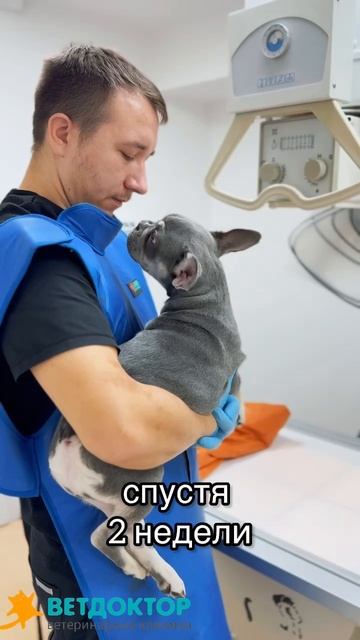 Перелом плеча.