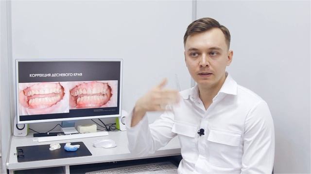 Цифровое планирование улыбки и воплощение ее на практике. Ты сам создаешь себя