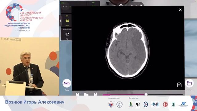 Мастер класс лечение инсульта Вознюк ИА  СПб 2023