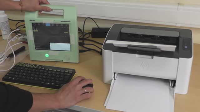 Фетальный монитор АНГИОДИН-ФМ. Ввод в эксплуатацию