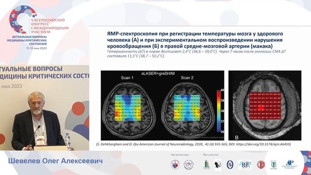 Микроволновая радиотермометрия мозга Шевелев ОА  СПб 2023