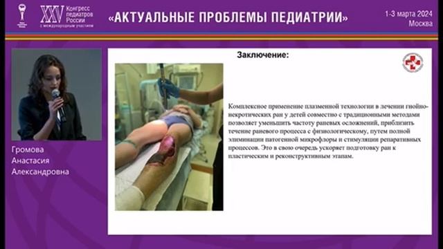 Роль аргоно-плазменных технологий в лечении ран у детей. Часть 2