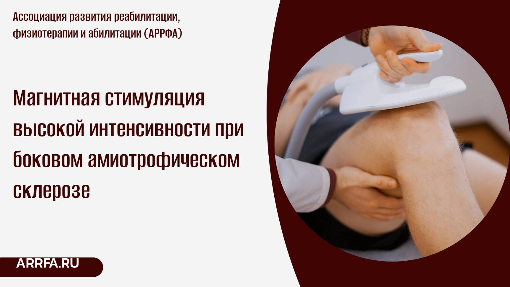 Магнитная стимуляция высокой интенсивности при боковом амиотрофическом склерозе (БАС)