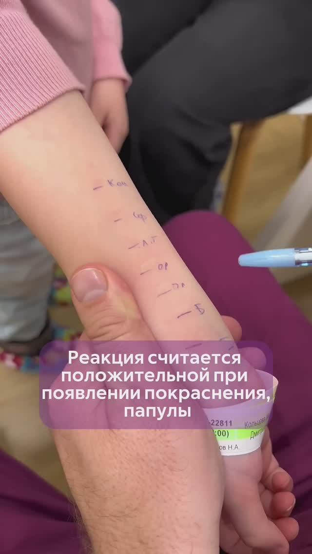 Как проходят кожные тесты на аллергию?