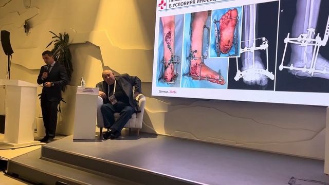 Лечение минно-взрывной травмы у детей. Ошибки и осложнения